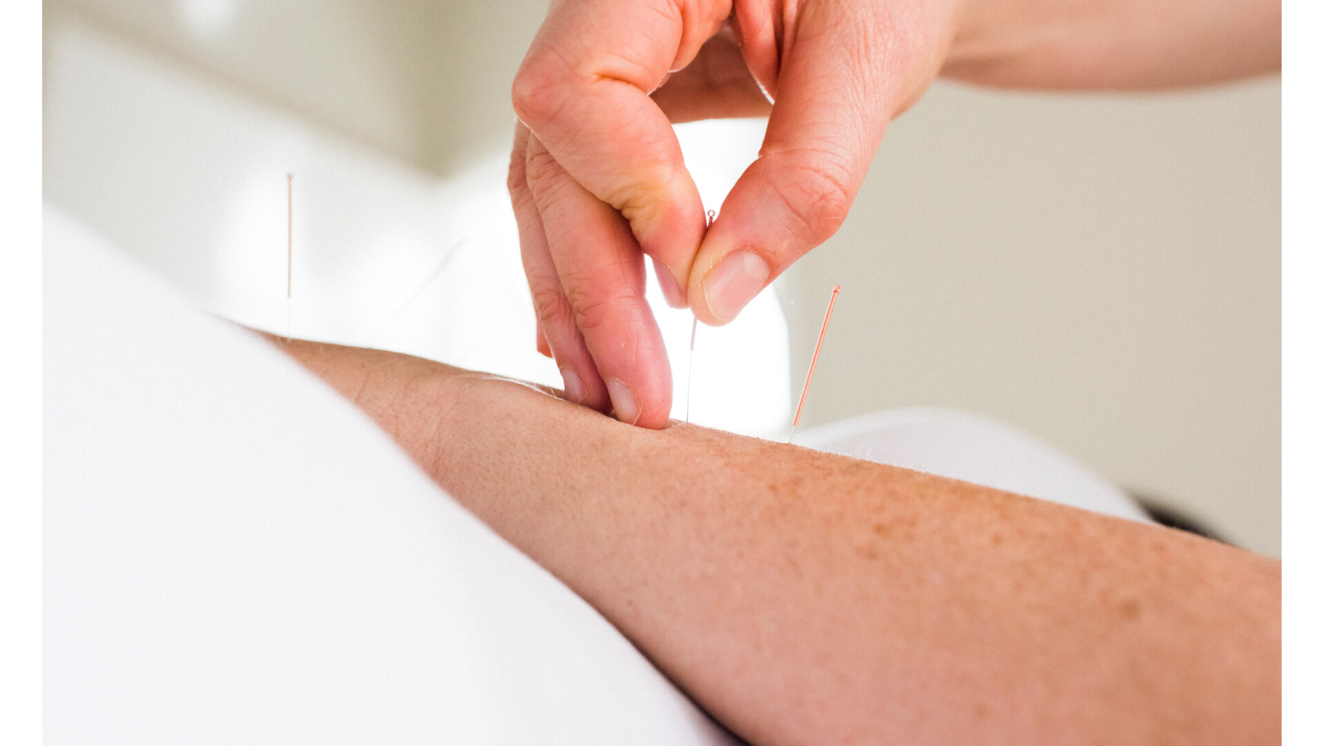 Meet Newton Ho Traditional Acupuncturist - Stony Acupuncture
